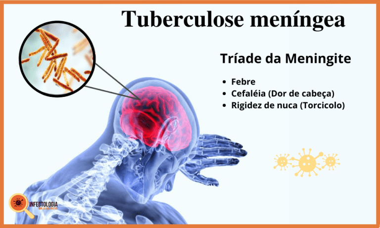 Sintomas de Tuberculose